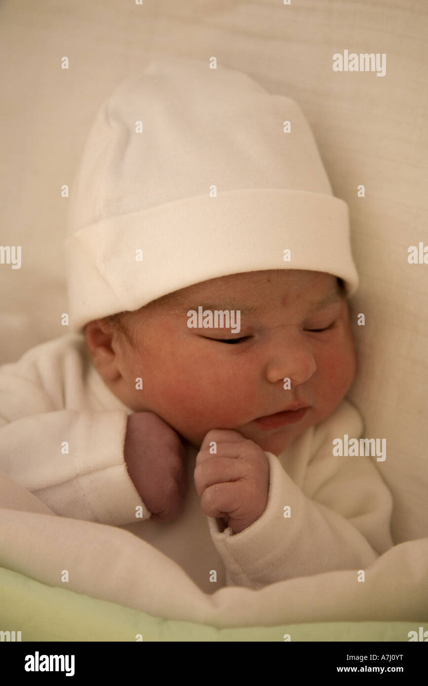 Baby with cradle cap hi-res stock photography and images - Alamy