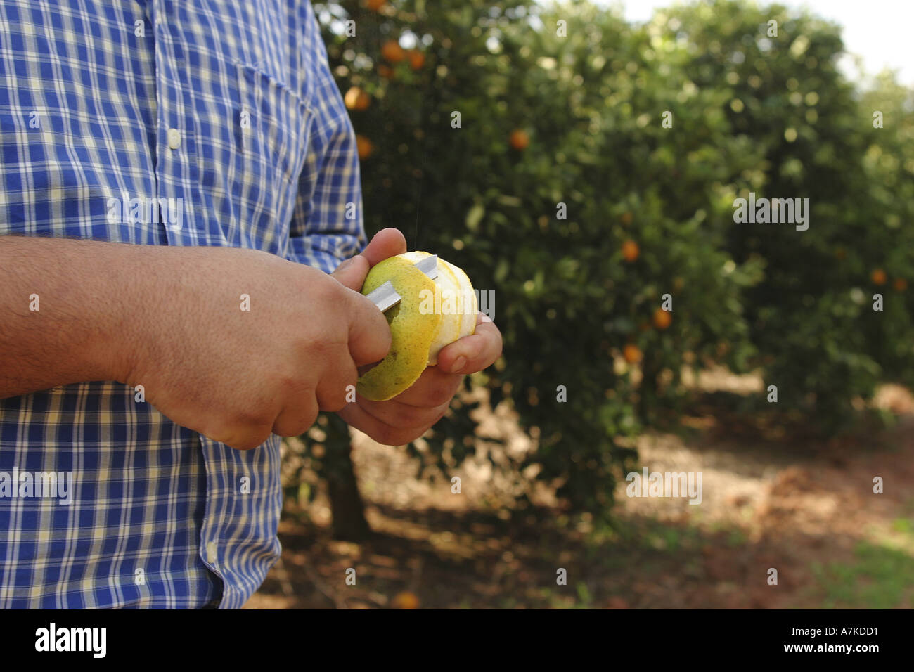 Skin peeling off hands hi-res stock photography and images - Alamy
