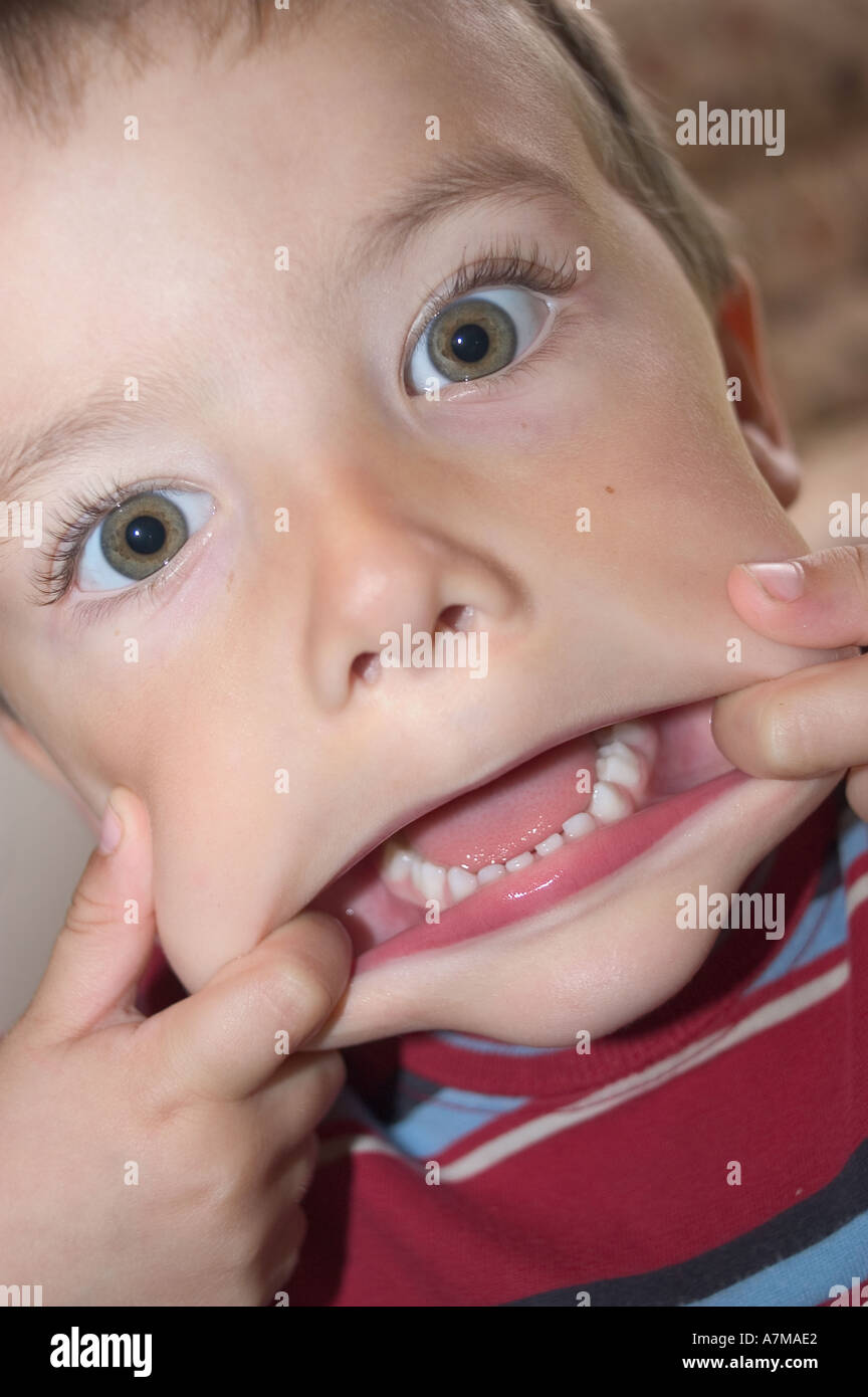 Boy pulling teeth hi-res stock photography and images - Alamy