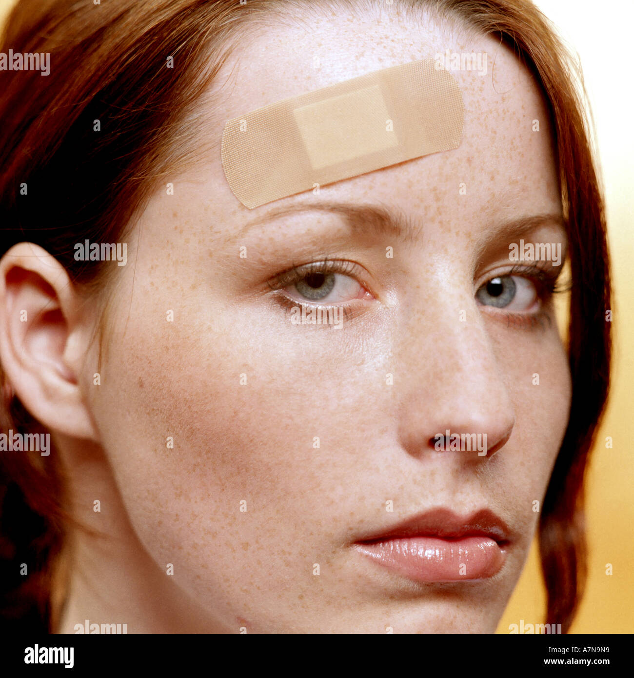 Laceration wound forehead hi-res stock photography and images - Alamy