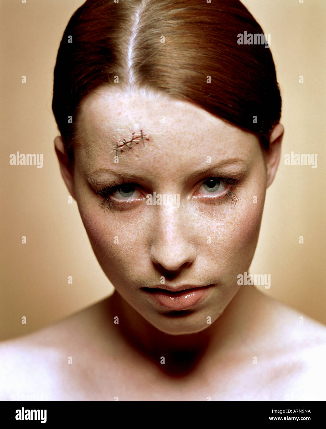 Laceration wound forehead hi-res stock photography and images - Alamy