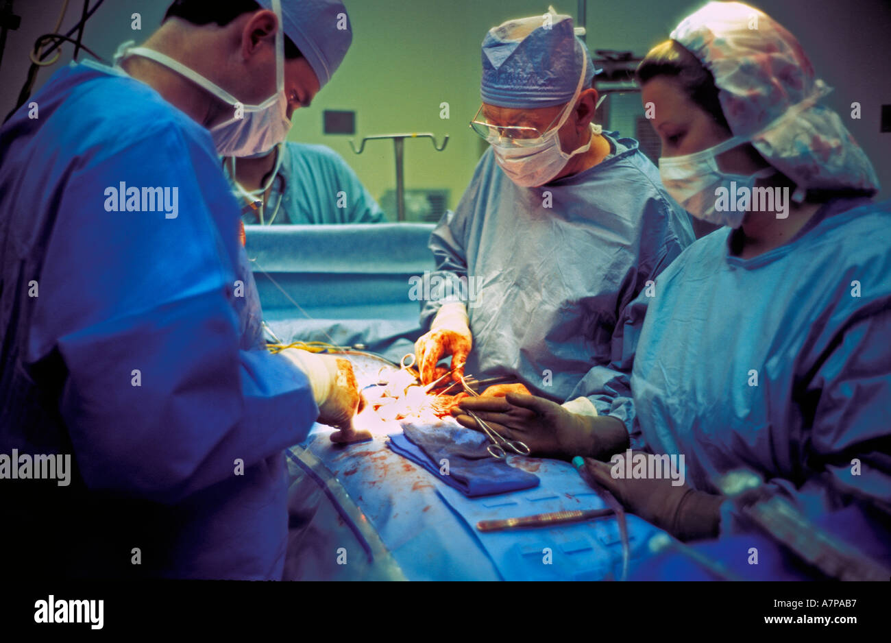 Surgical team performs kidney transplant in operating room Stock Photo ...