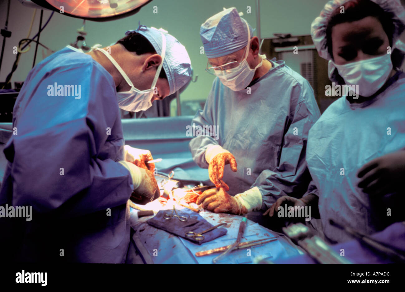 Surgical team performs kidney transplant in operating room Stock Photo ...