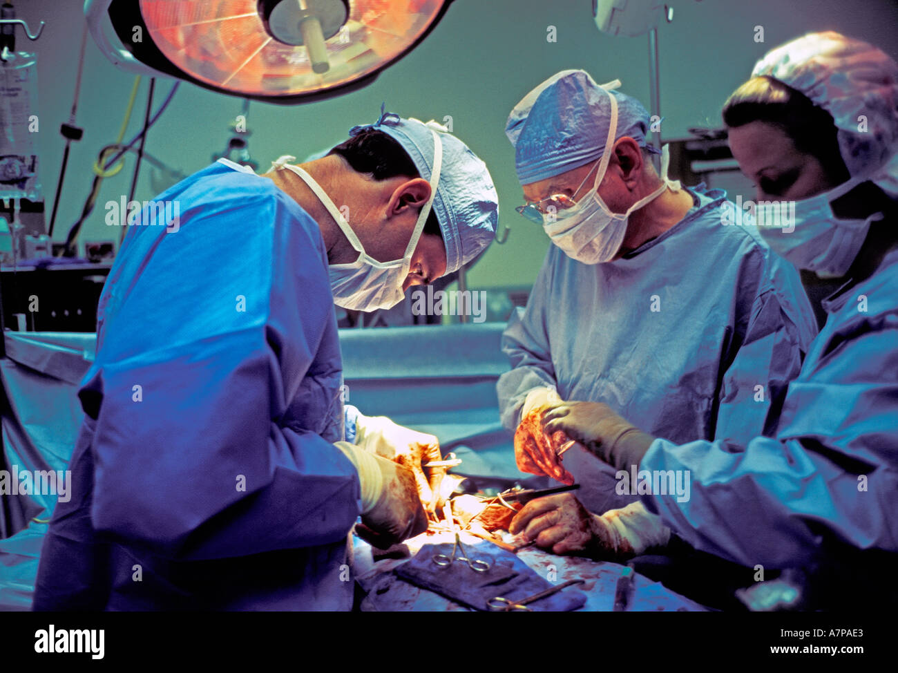 Surgical team performs kidney transplant in operating room Stock Photo ...