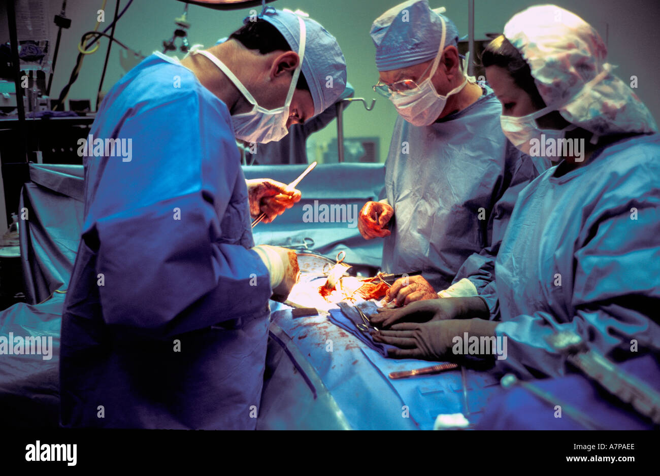 Surgical team performs kidney transplant in operating room Stock Photo ...