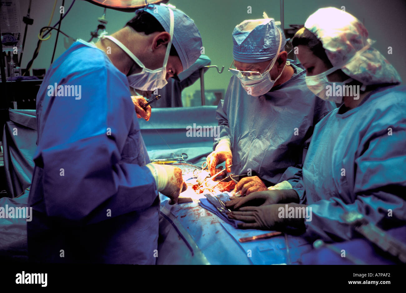 Surgical team performs kidney transplant in operating room Stock Photo ...