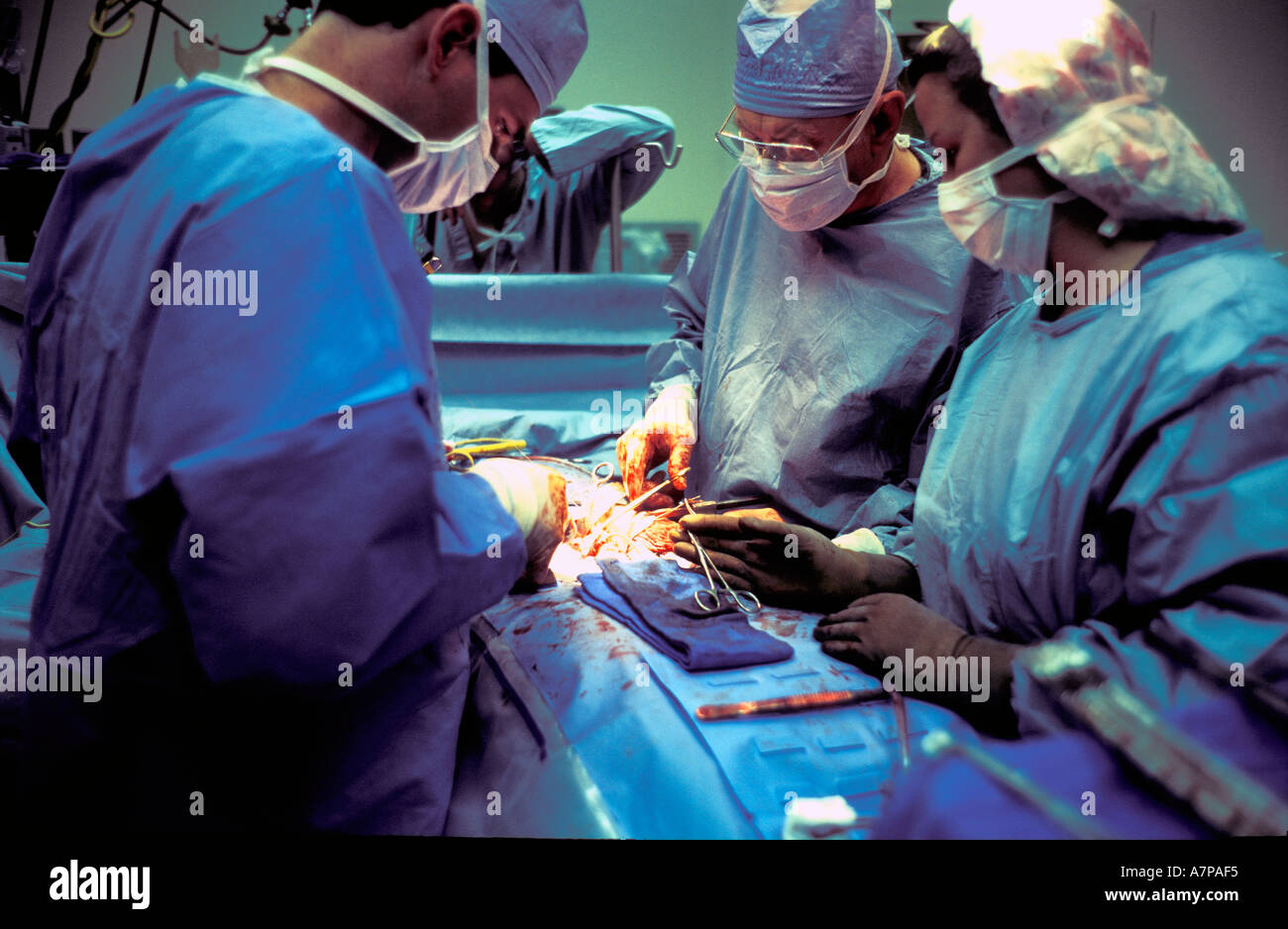 Surgical team performs kidney transplant in operating room Stock Photo ...