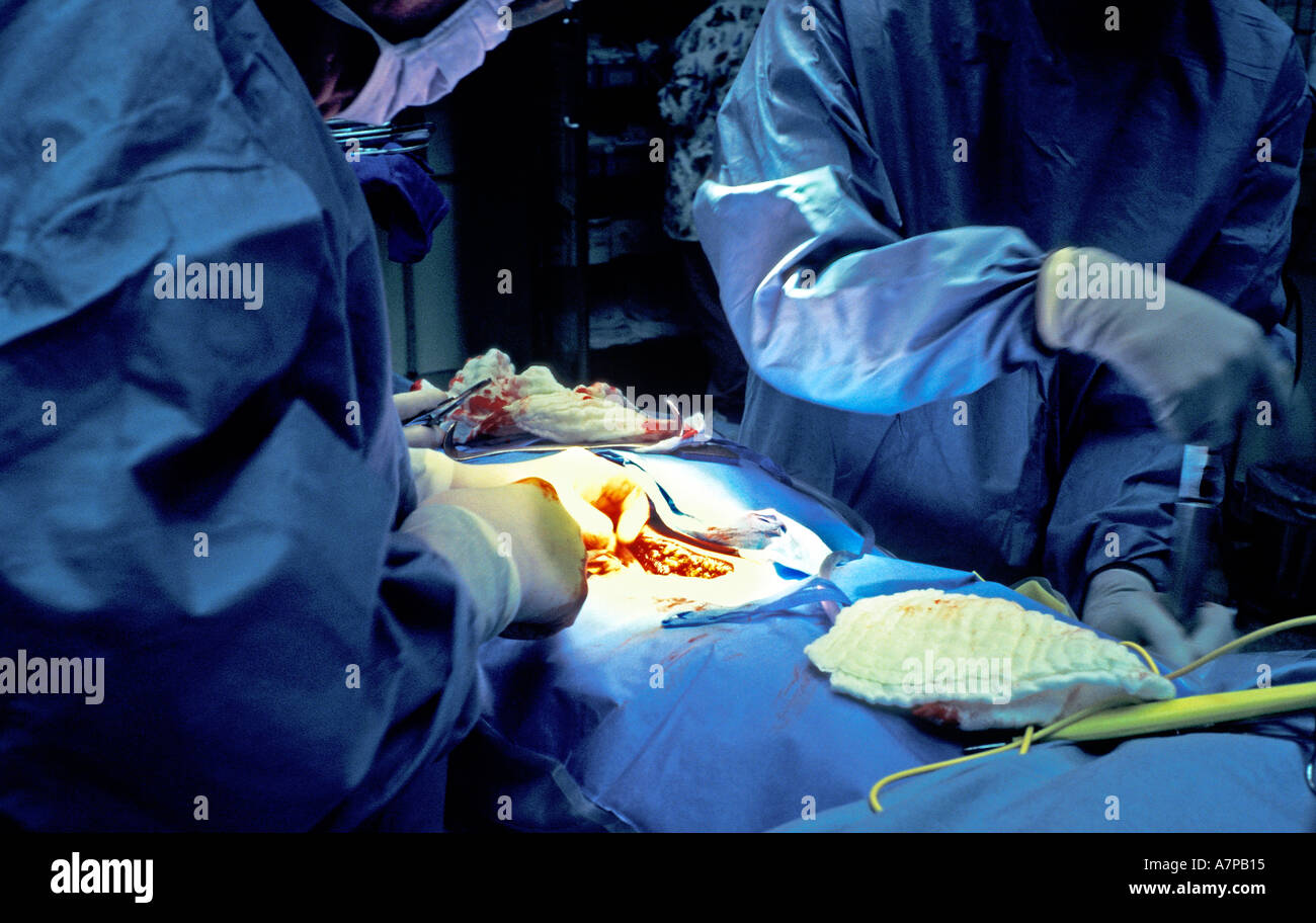 Surgical team performs kidney transplant in operating room Stock Photo ...