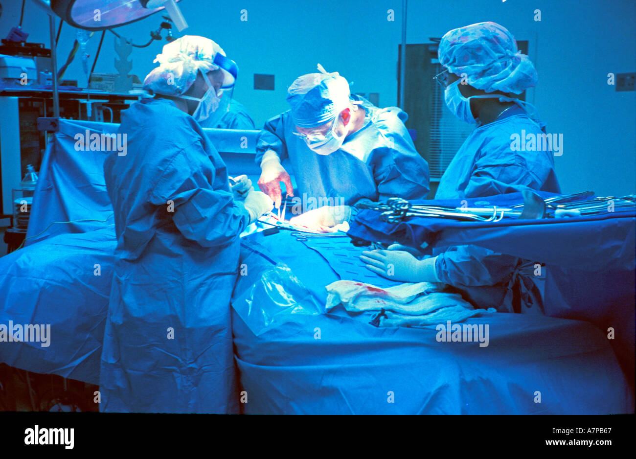 Surgical team performs kidney transplant in operating room Stock Photo ...