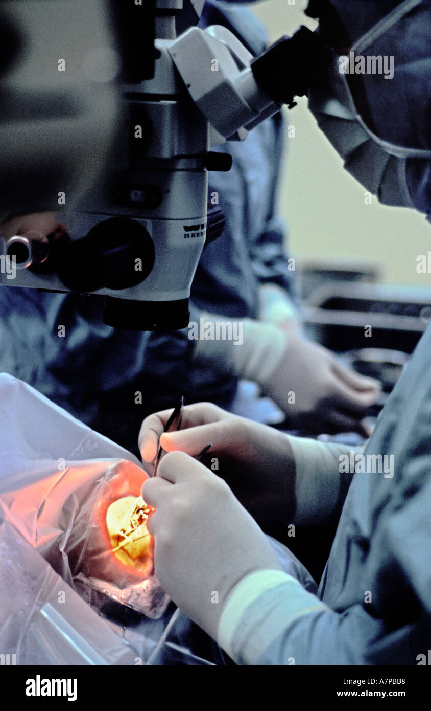 Ophthalmologist uses electronic overhead operating microscope to ...