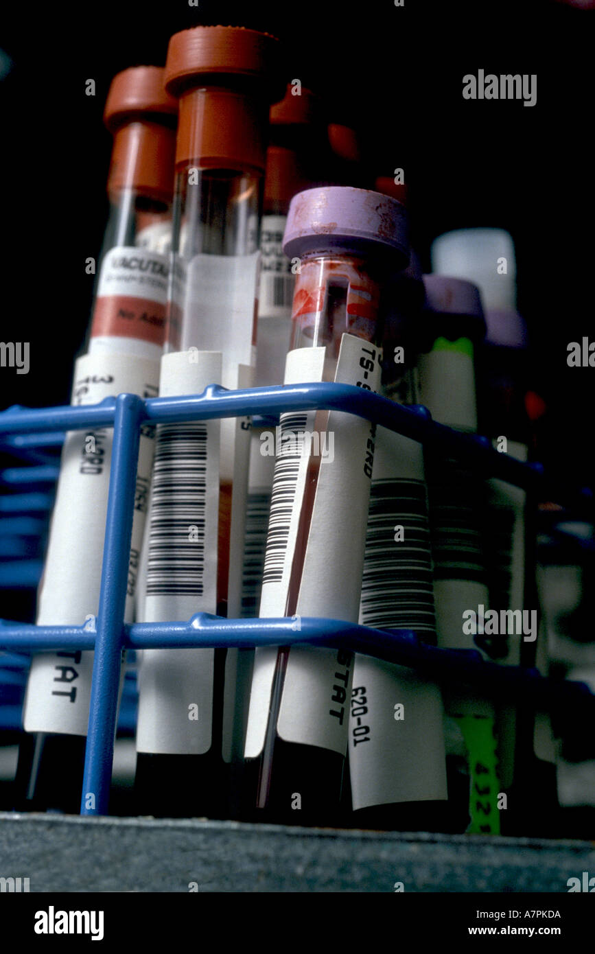 Blood samples await testing in hospital cooler Stock Photo - Alamy