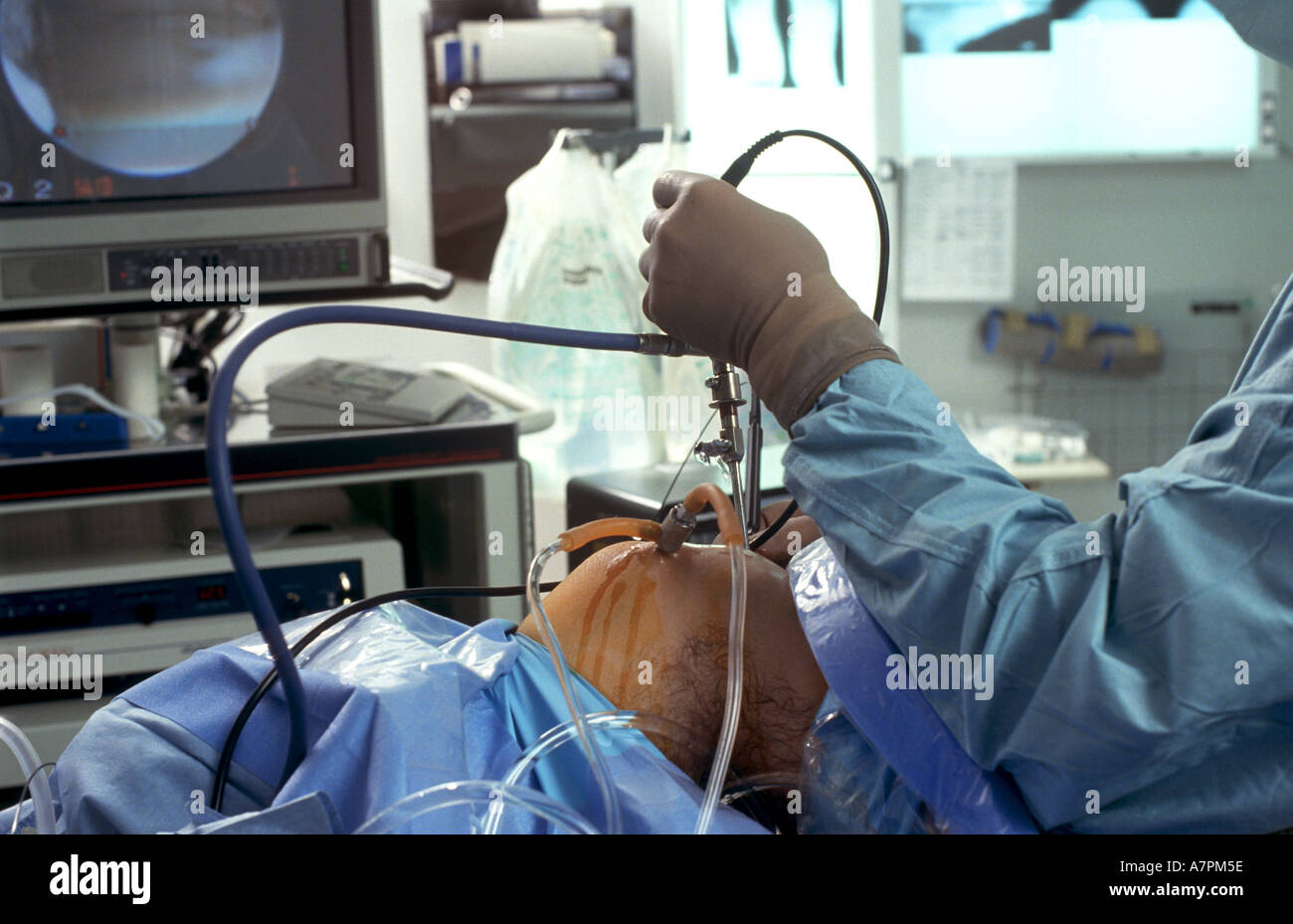 Knee surgery hi-res stock photography and images - Alamy