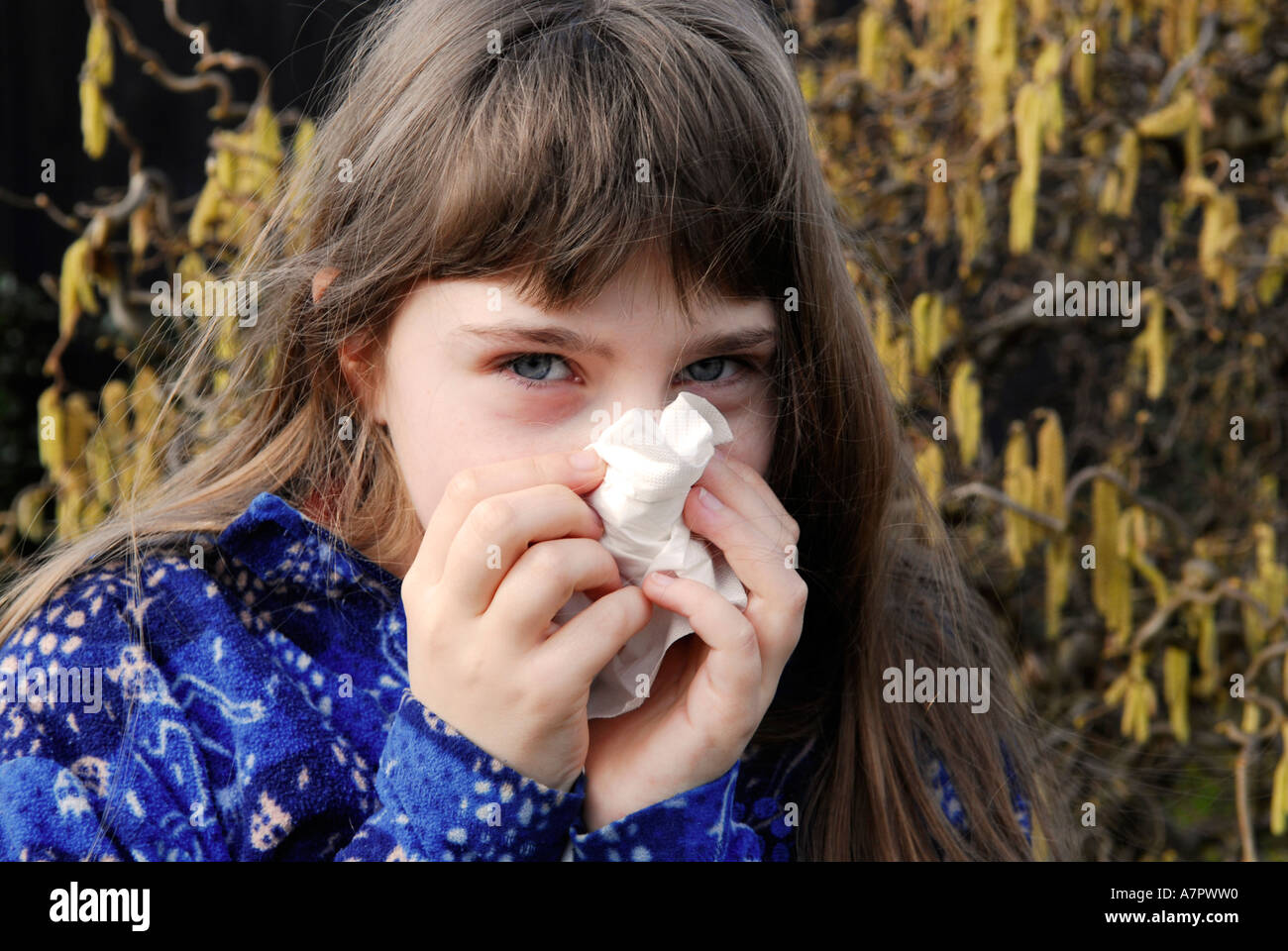 Child with hay fever Stock Photo - Alamy