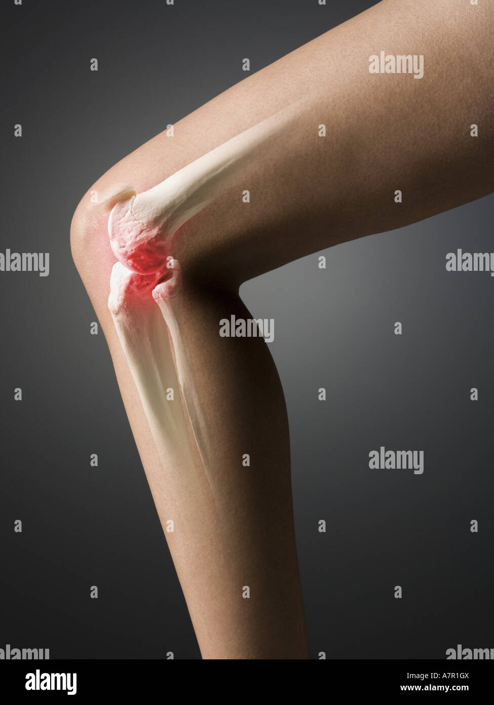 MRI like image of knee with inflammation Stock Photo - Alamy