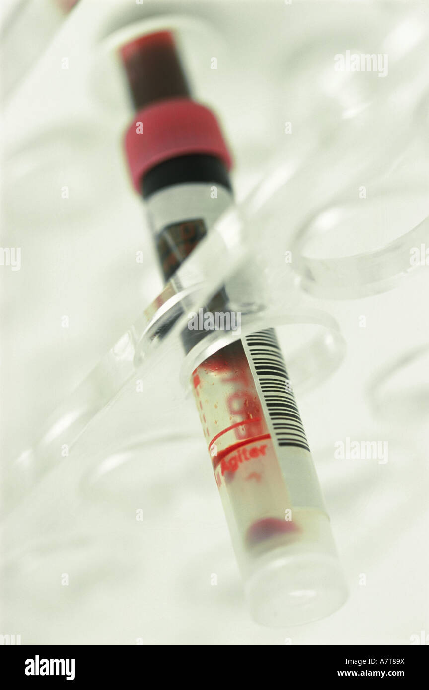Low angle view of test tube with blood sample in test tube rack Stock ...