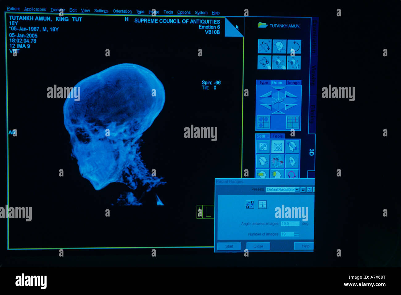 Tutankhamun mummy hi-res stock photography and images - Alamy