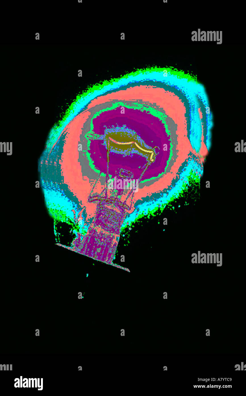 Conceptual image of incandescent light bulb exploding in the dark Stock ...