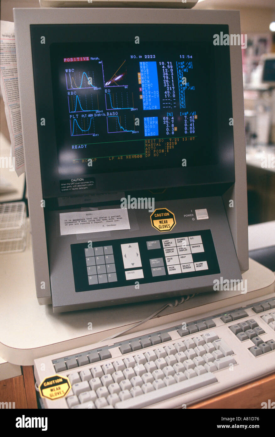 complete blood count with 5 five part differential Stock Photo - Alamy