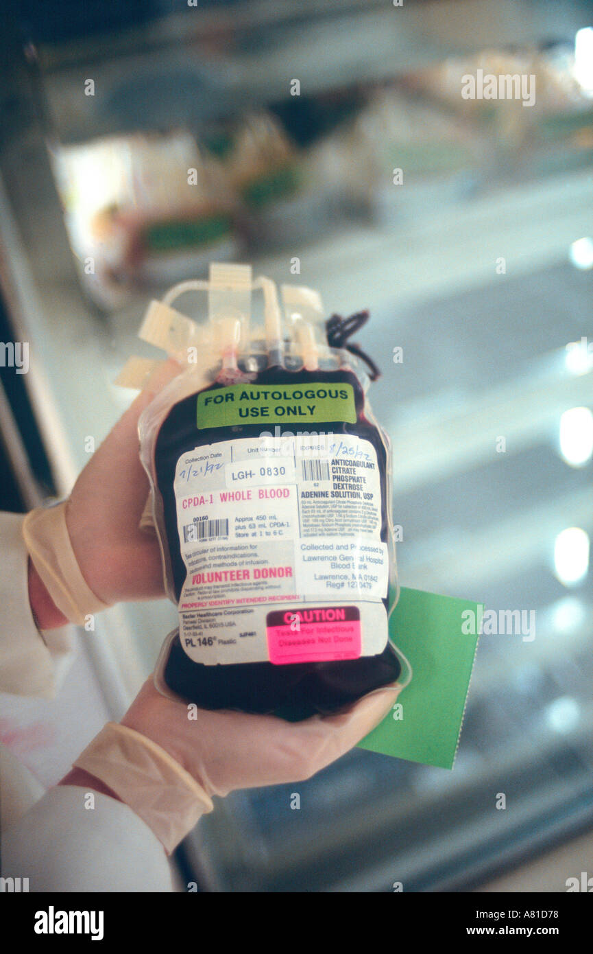 Autologous hi-res stock photography and images - Alamy