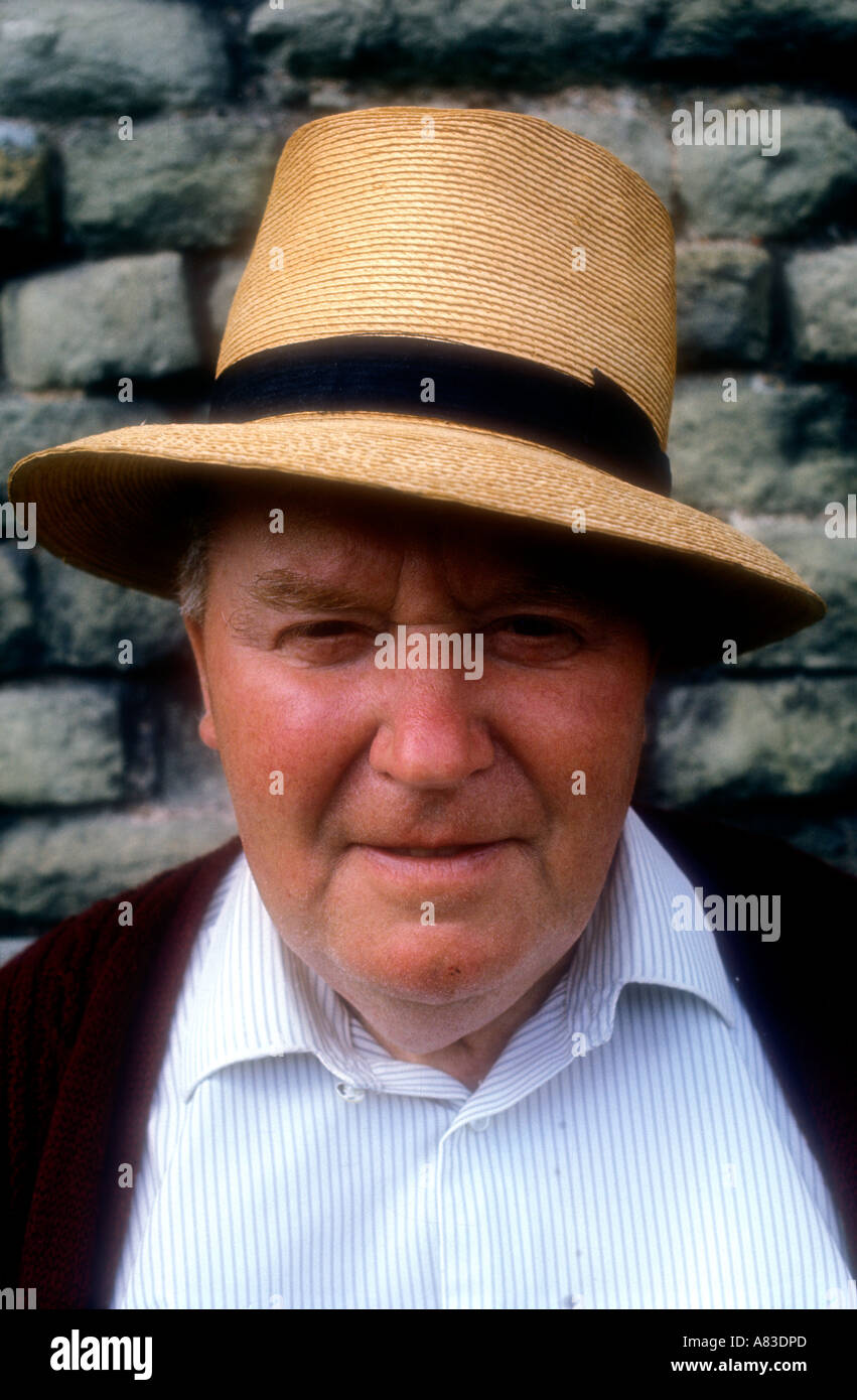 Ruddy complexion hi-res stock photography and images - Alamy