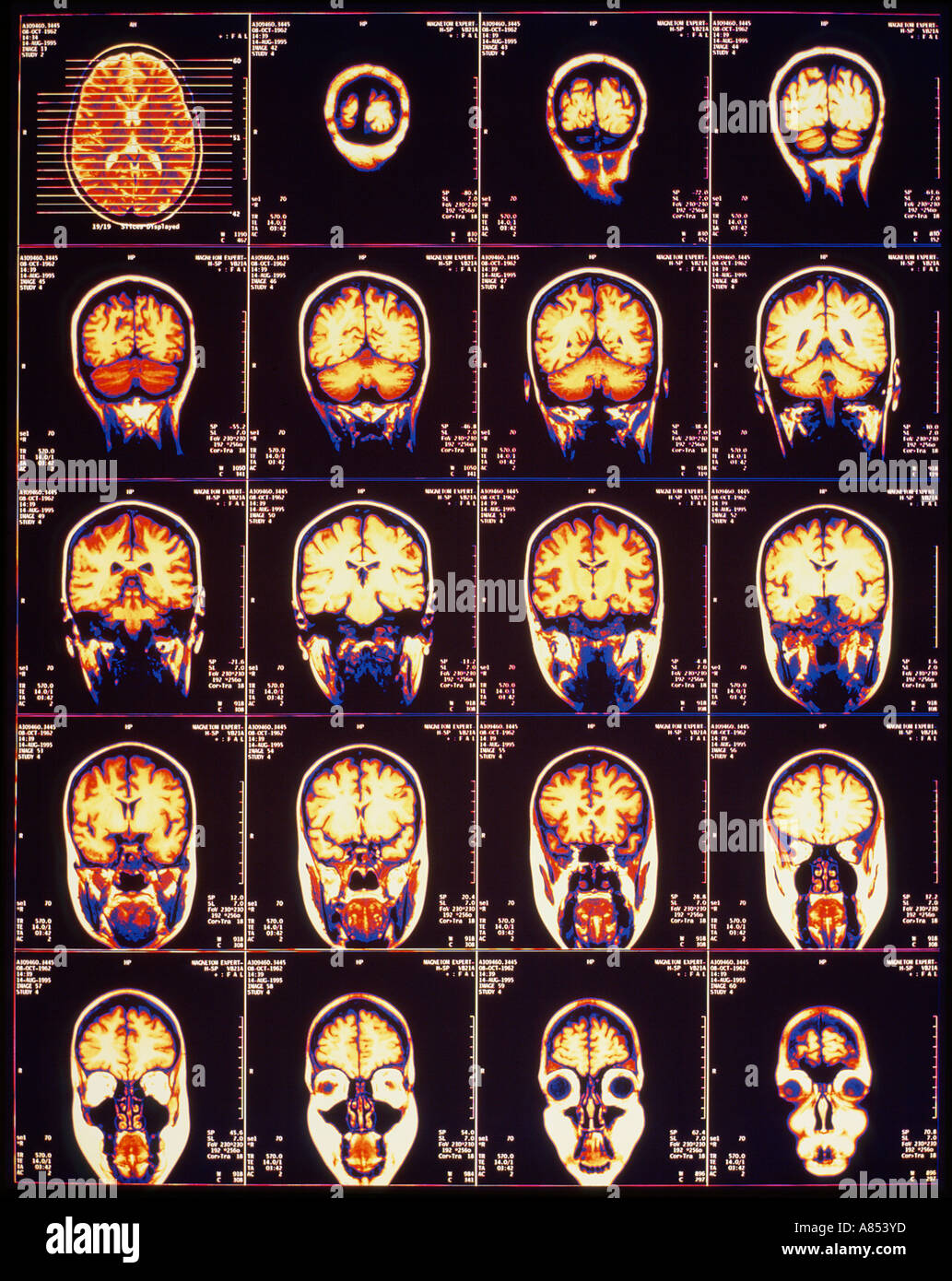 Multiple diagnostic Images of human brain Stock Photo - Alamy