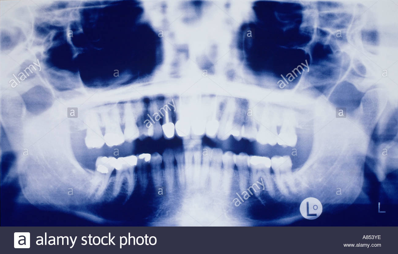 Dental Ct Scan High Resolution Stock Photography and Images - Alamy