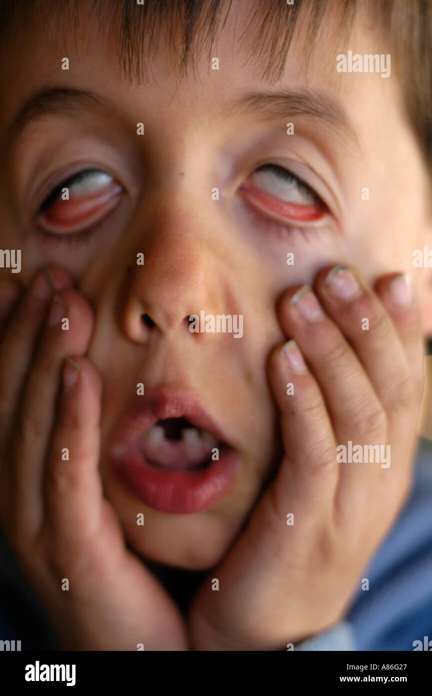 Two boys making faces hi-res stock photography and images - Alamy