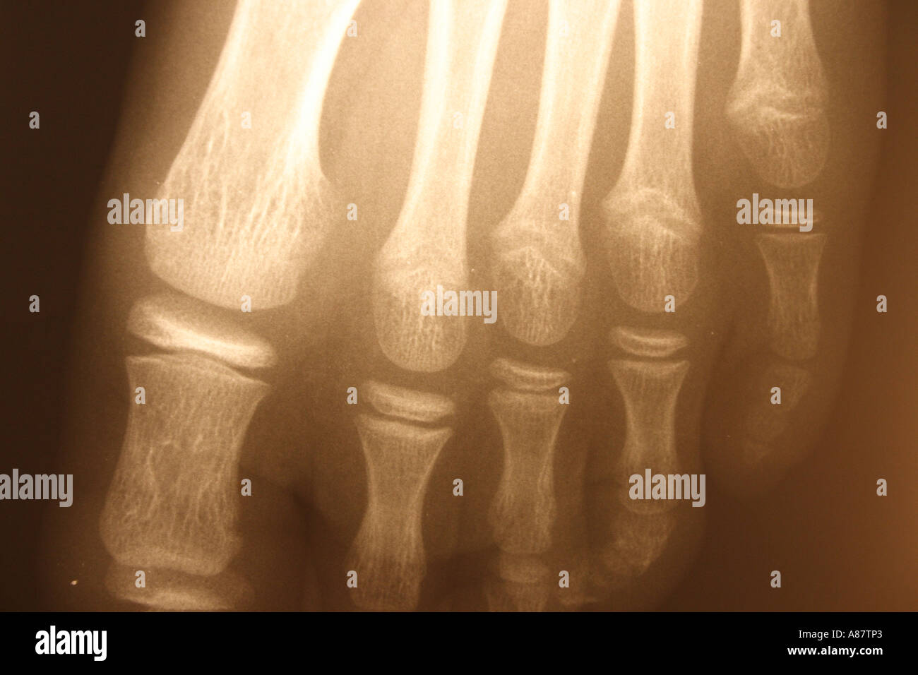 Aspect of patient hi-res stock photography and images - Alamy