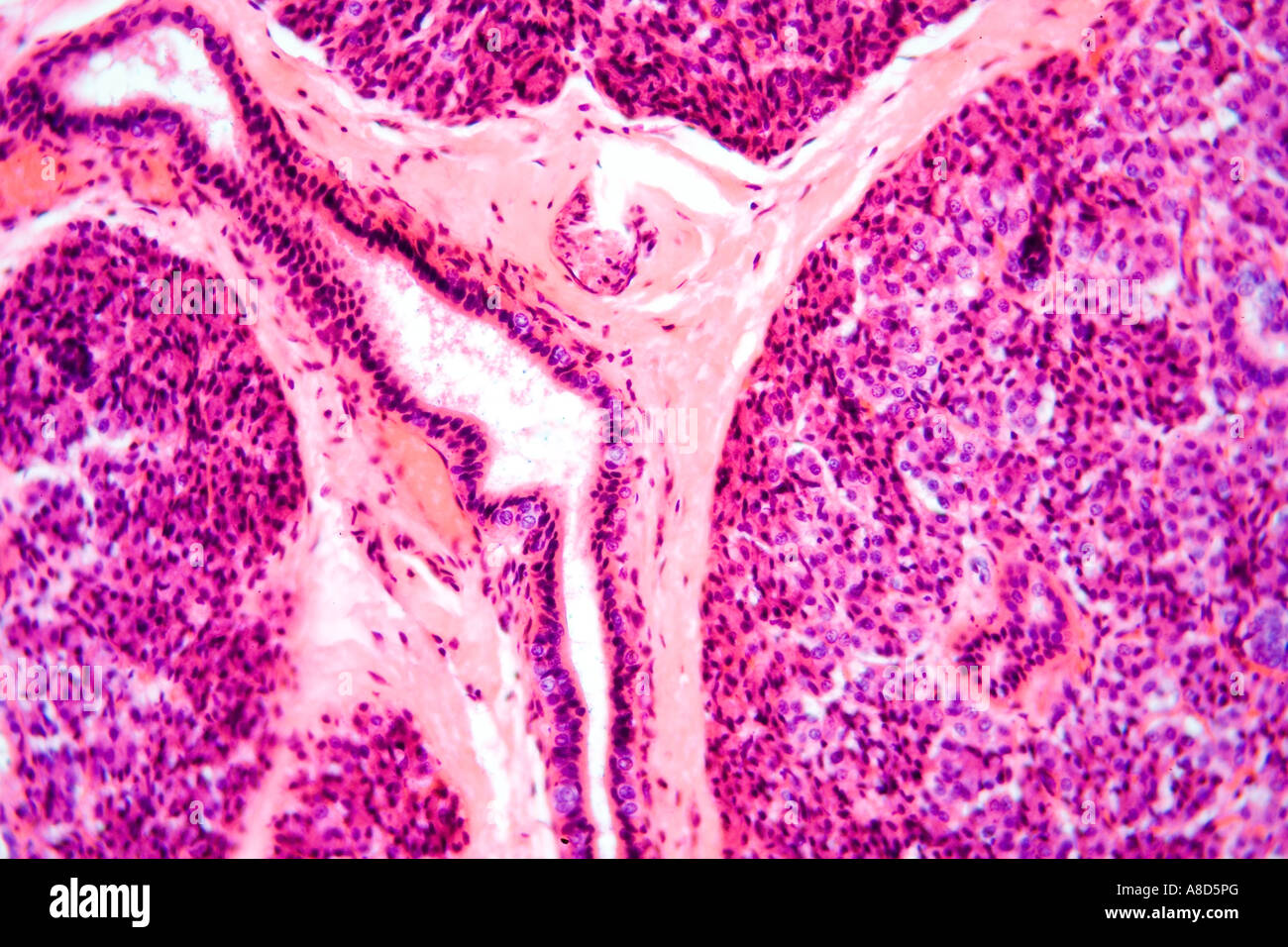 Human liver section brightfield photomicrograph Stock Photo - Alamy