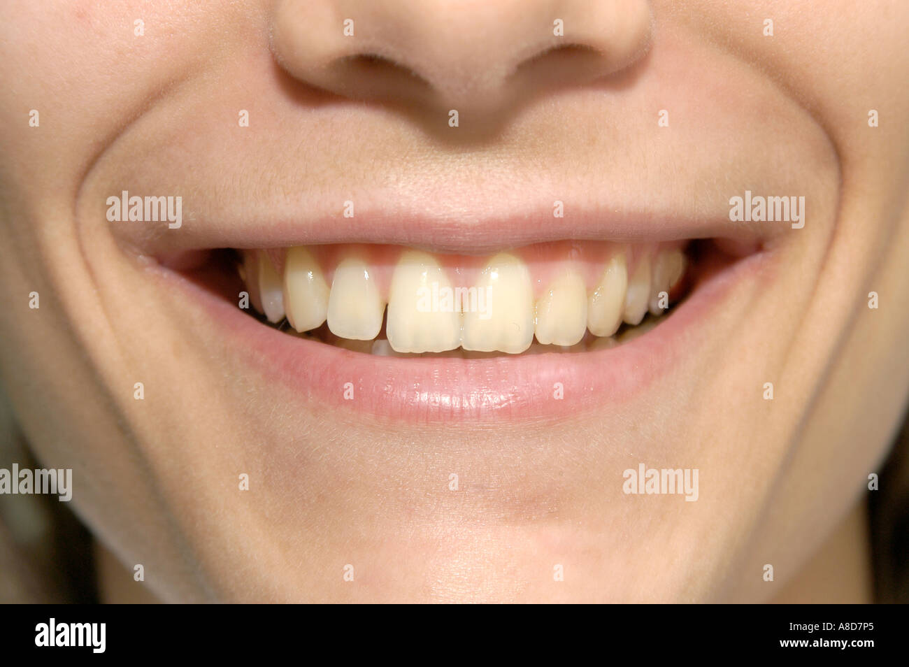 Teeth in a girls smiling face Stock Photo - Alamy