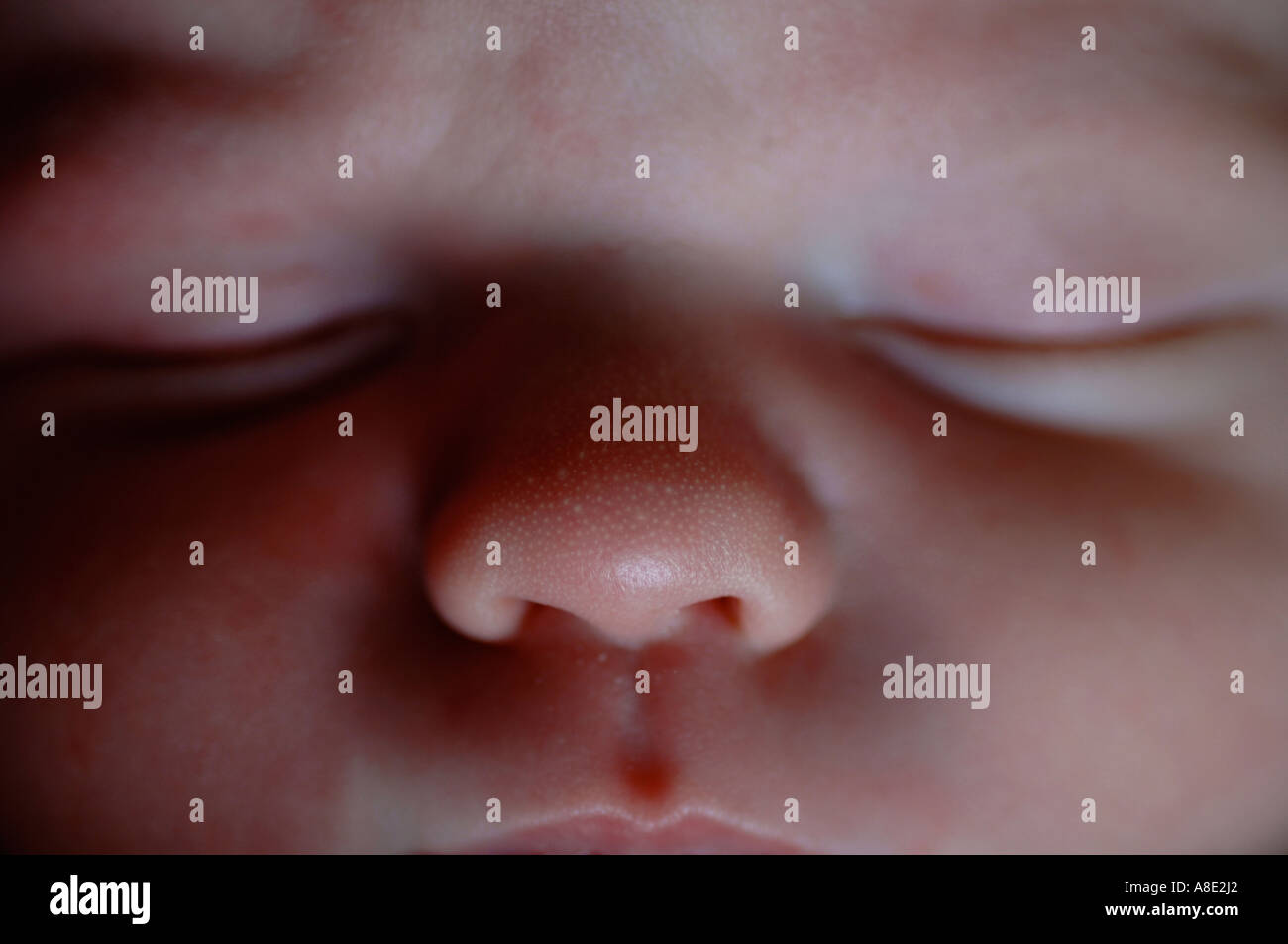 Milk spots or milia on baby's nose Stock Photo - Alamy