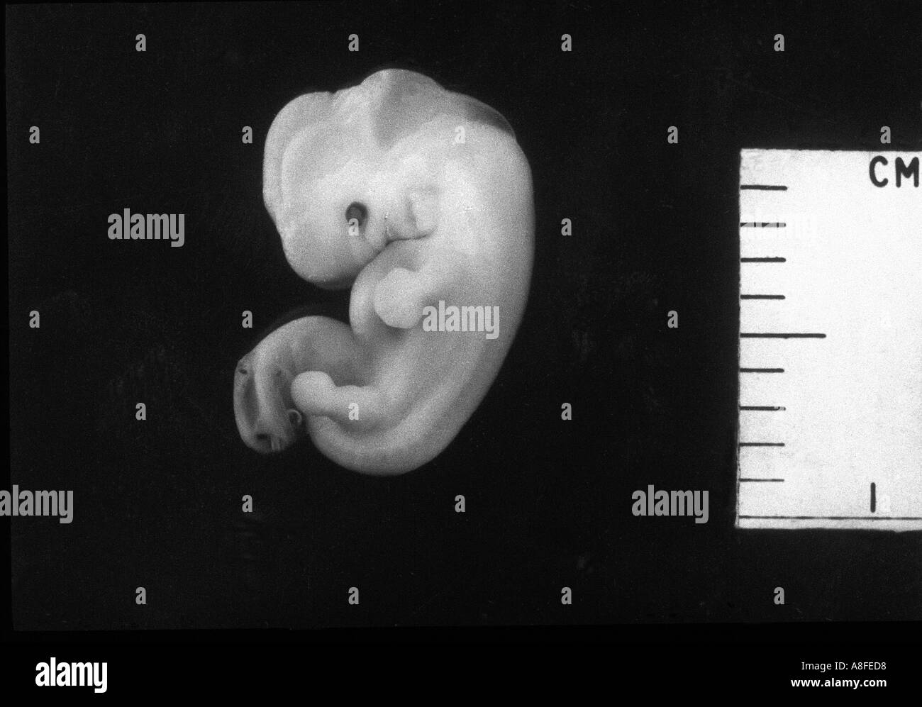 Foetal development hi-res stock photography and images - Alamy