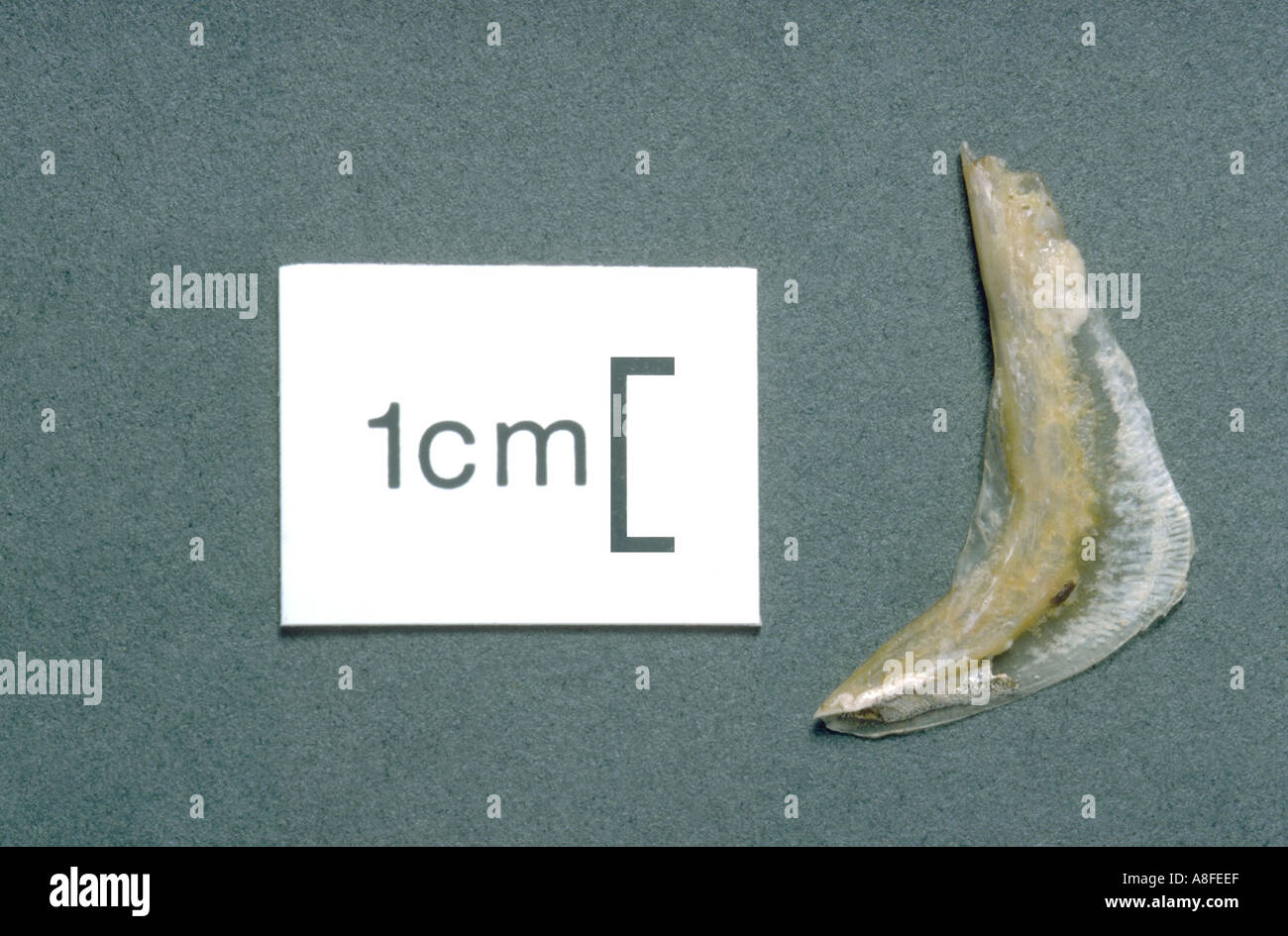 Foreign body x ray hi-res stock photography and images - Alamy