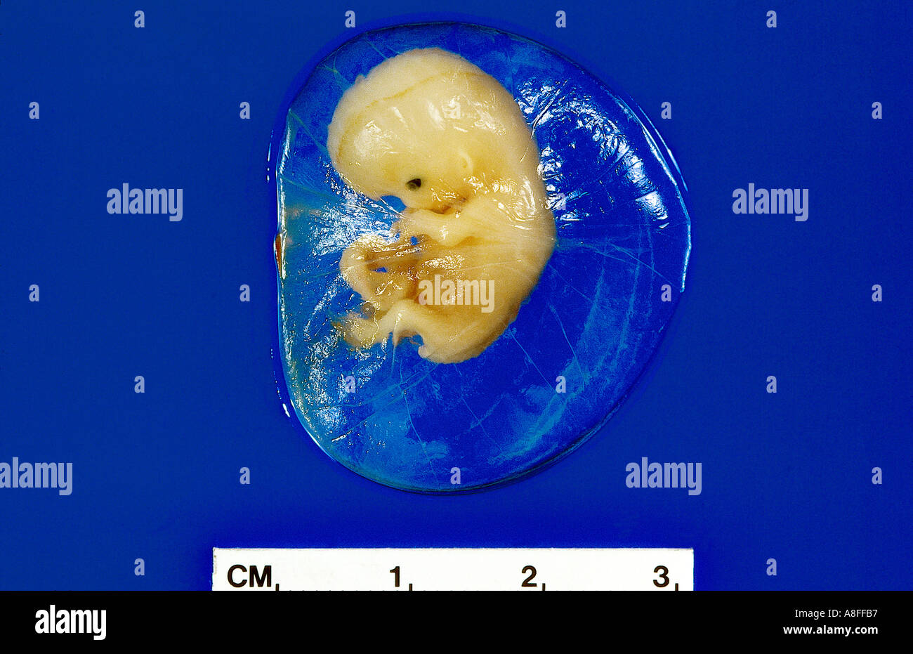 Embryo sac hi-res stock photography and images - Alamy