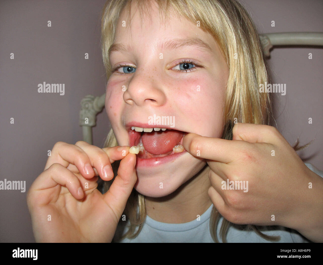 Loosing a Baby a Tooth Stock Photo - Alamy