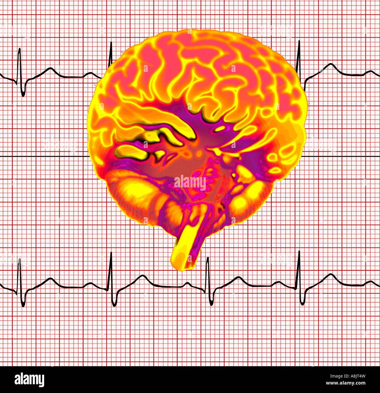 computer generated model of a human brain composited on a EKG printout ...