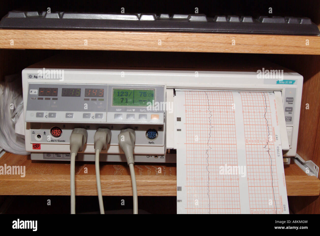 Machine used to monitor vital signs of pregnant woman in labor Stock ...
