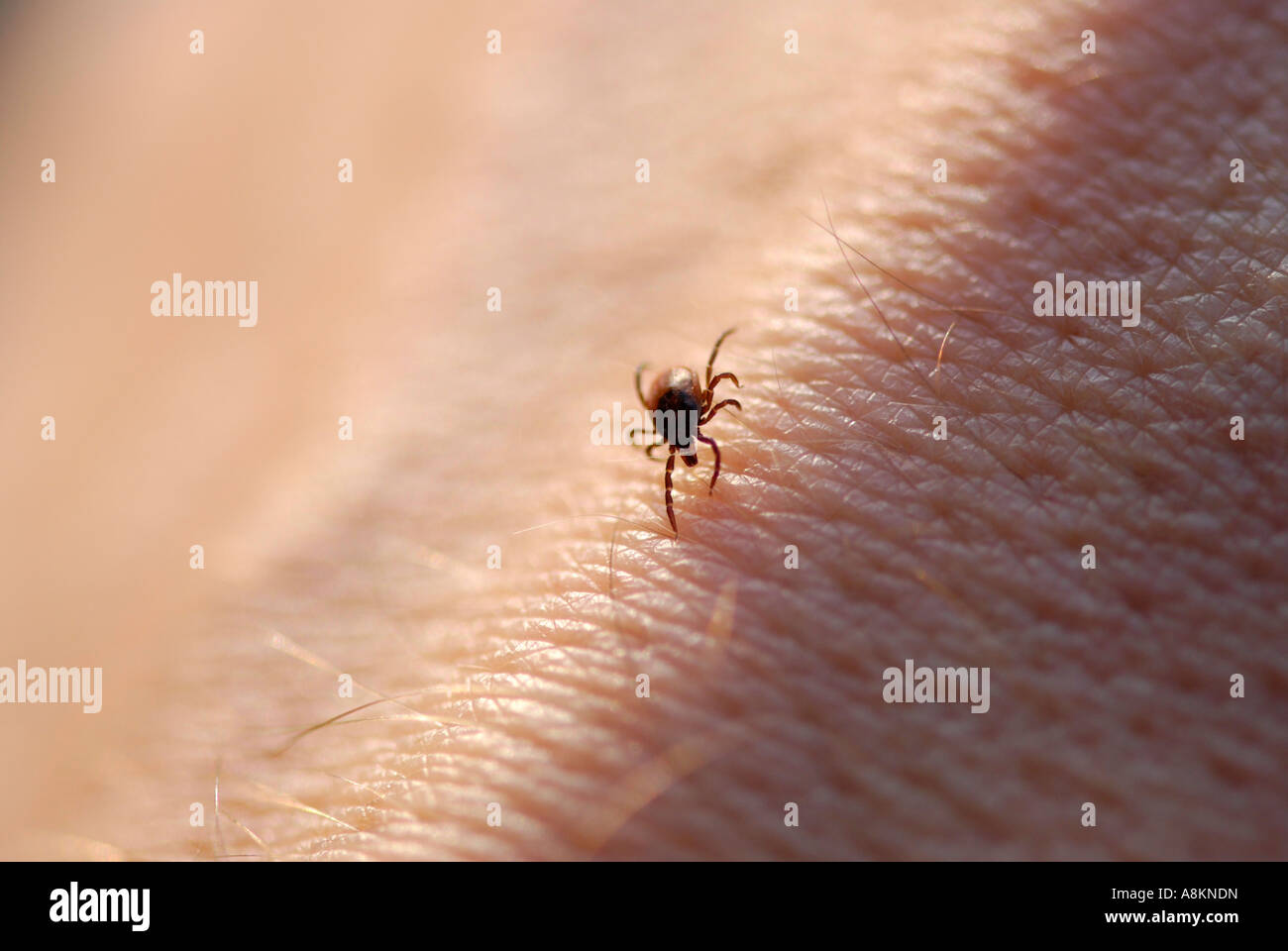 Zeckenbiss hi-res stock photography and images - Alamy