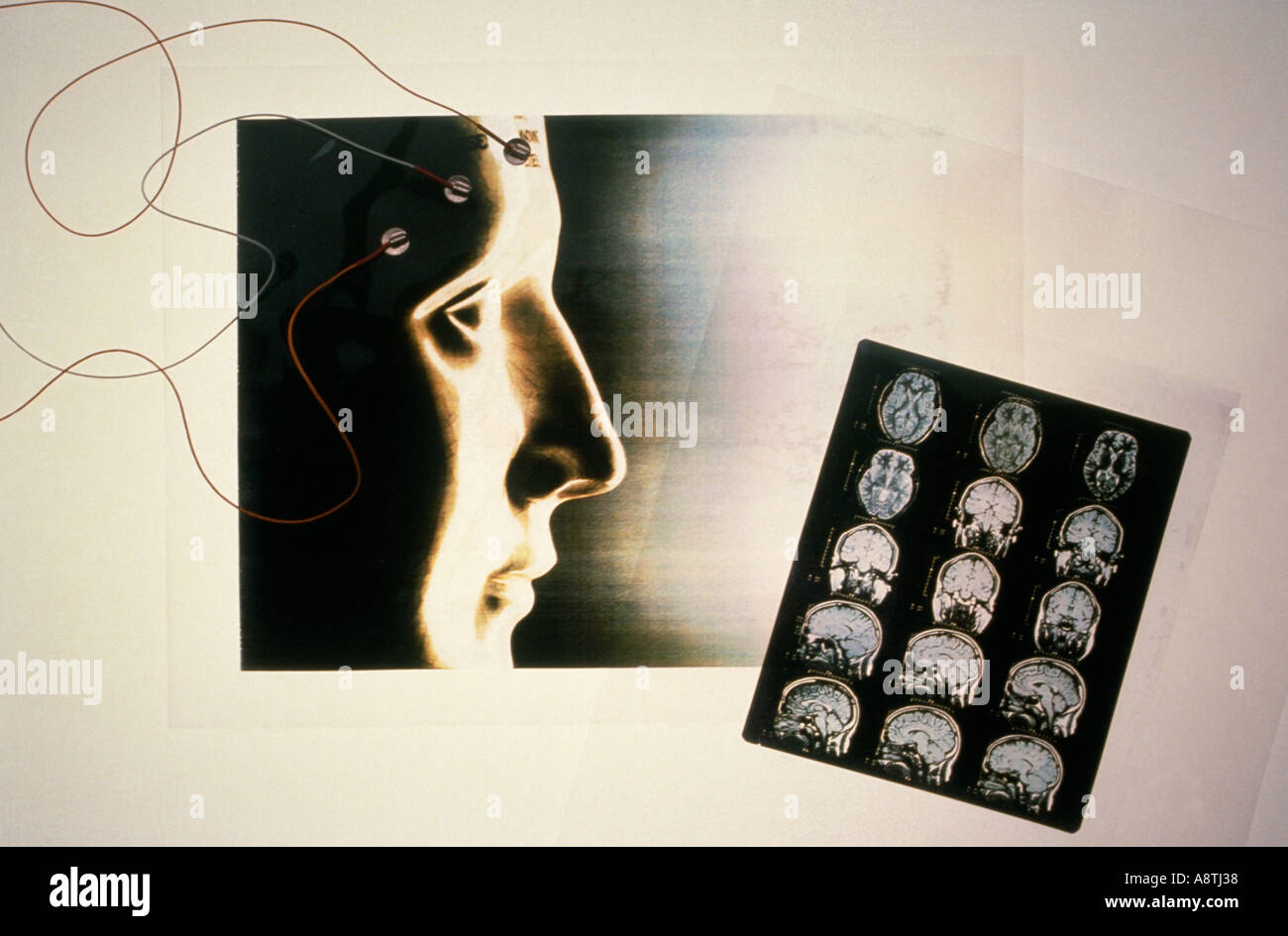 Sleep brain scan hi-res stock photography and images - Alamy