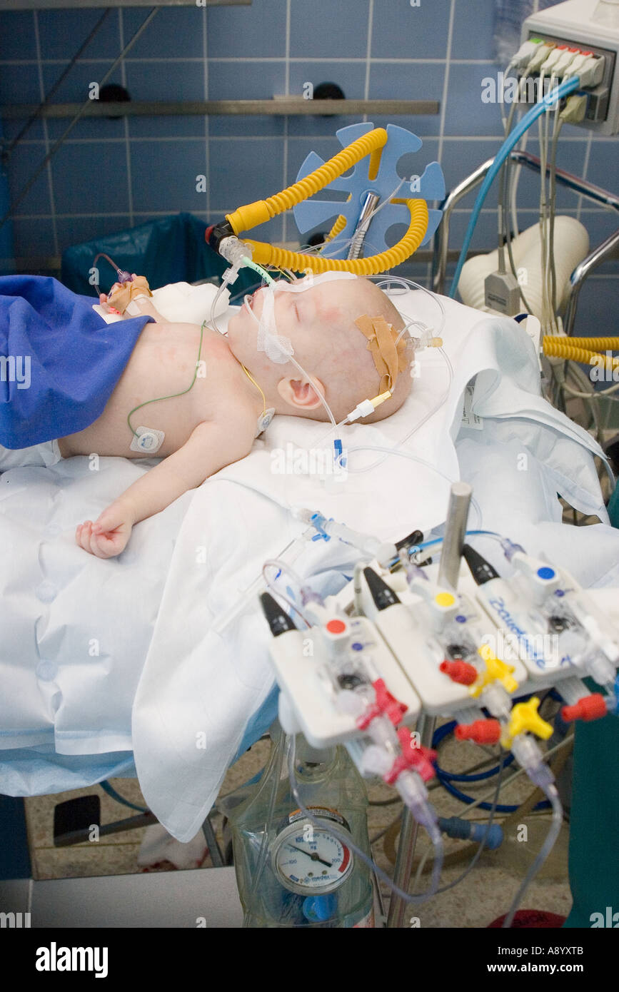 anesthesiologists preparing two month old baby patient for heart ...