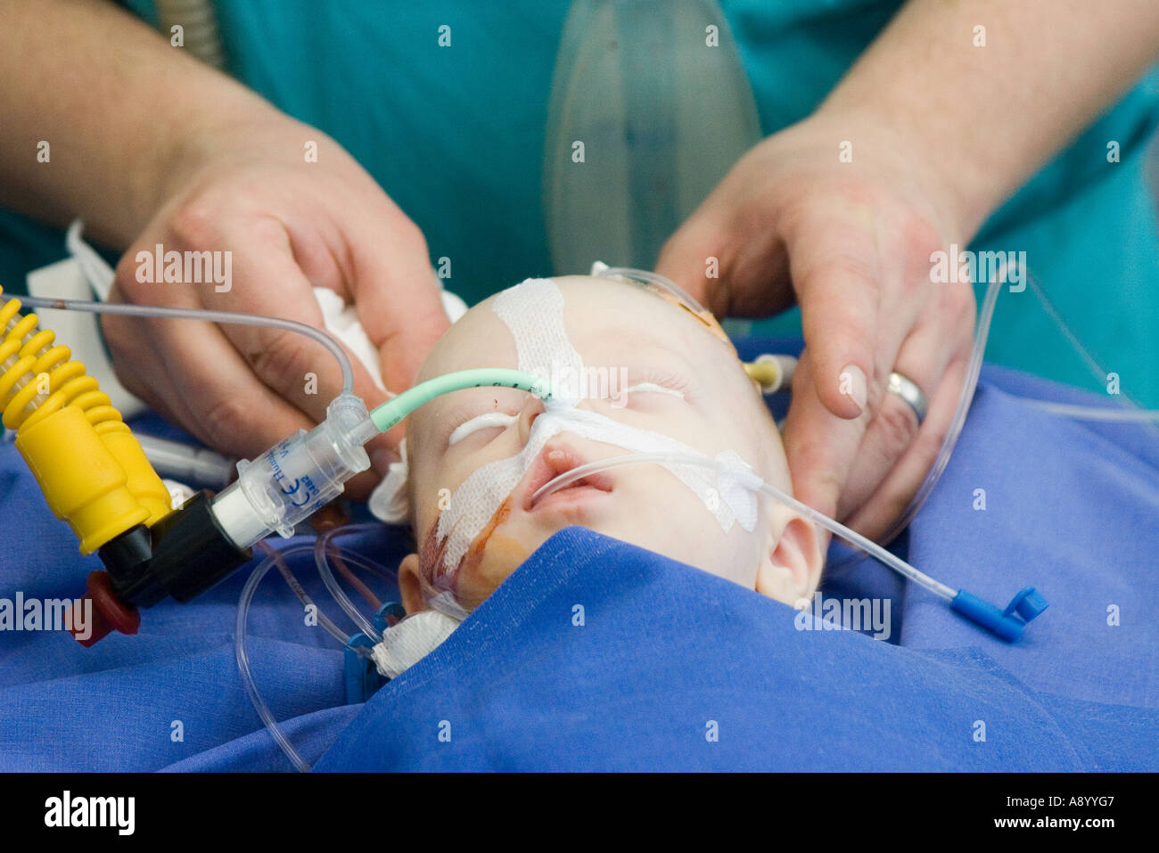 anesthesiologists preparing two month old baby patient for heart ...