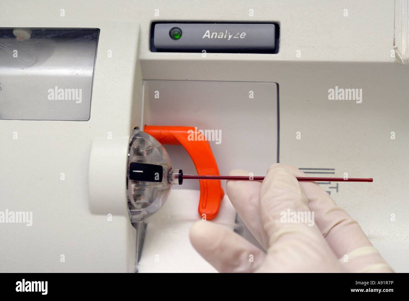 Blood gas hi-res stock photography and images - Alamy