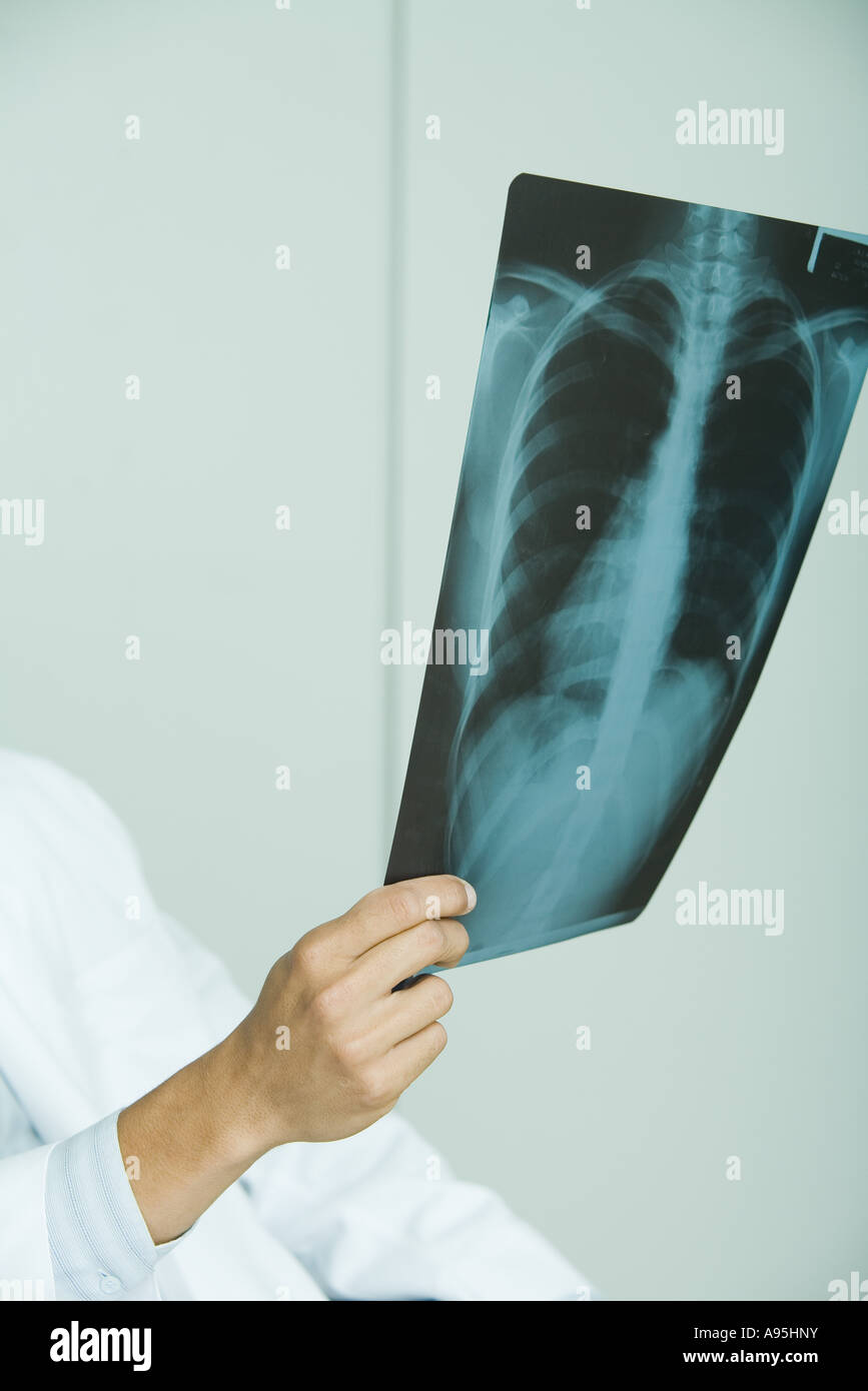 Doctor holding up x-ray of rib cage, partial view Stock Photo - Alamy