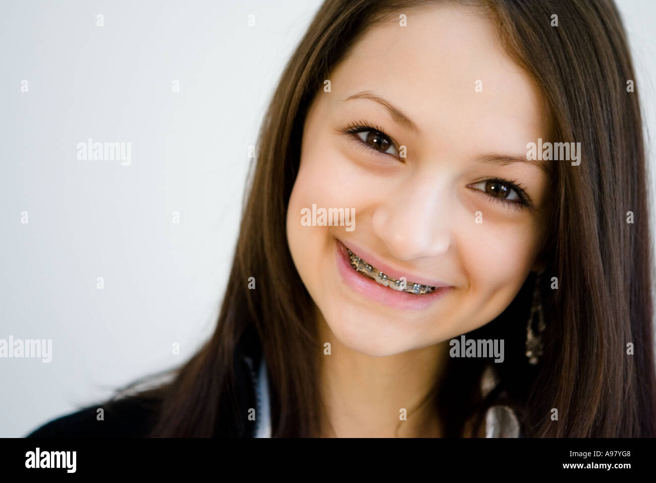 Face of a young pretty girl with dimples and braces smiling Stock Photo ...