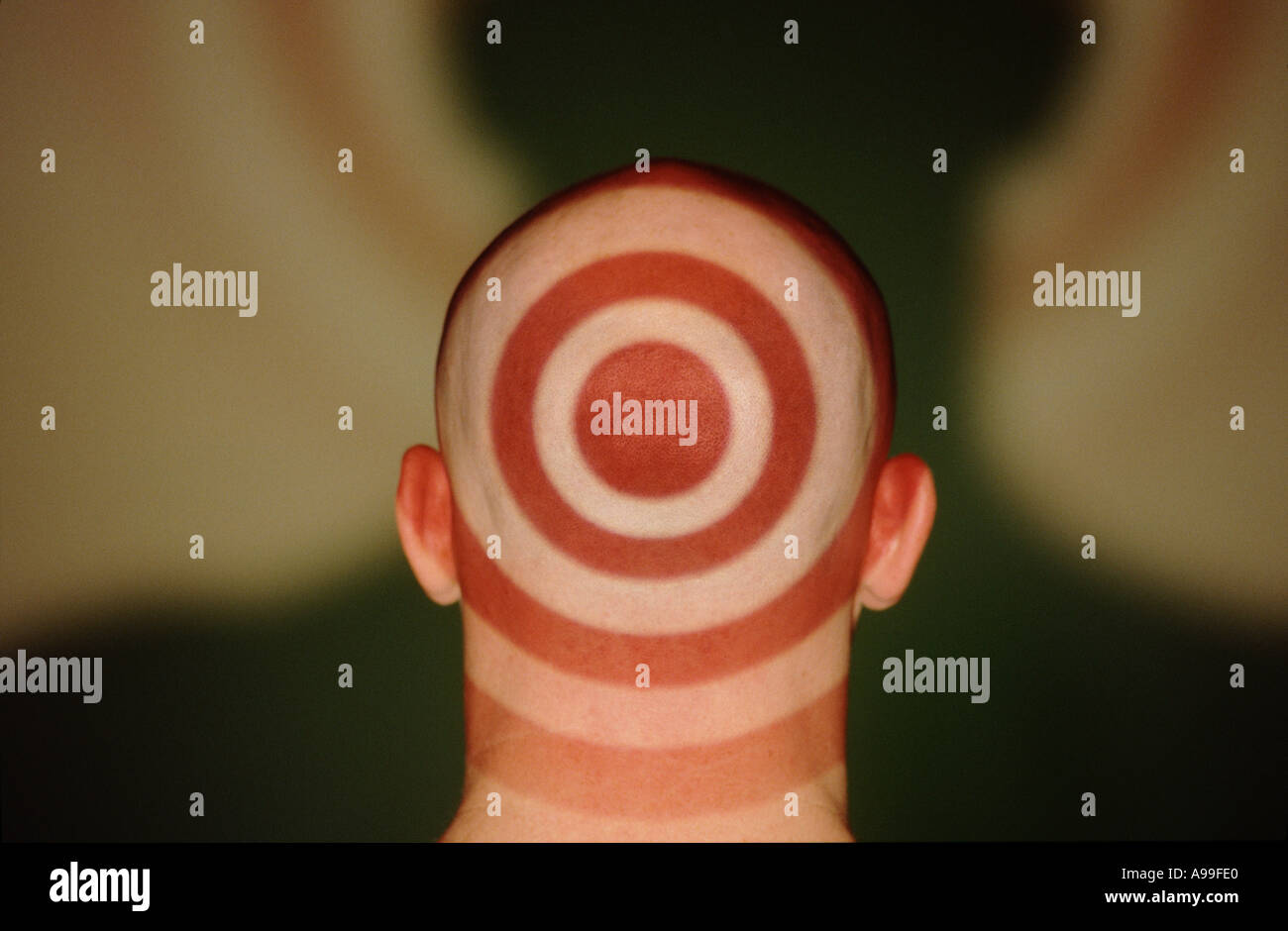 back of bald head with target superimposed Stock Photo - Alamy