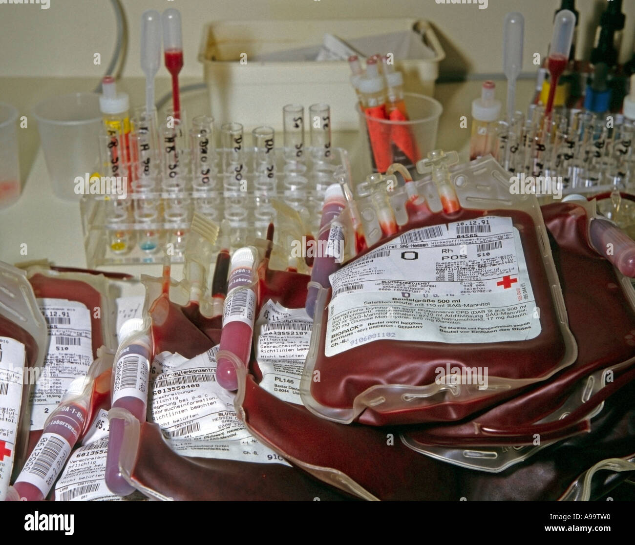 public health blood preserve preparations in a medical laboratory Stock ...