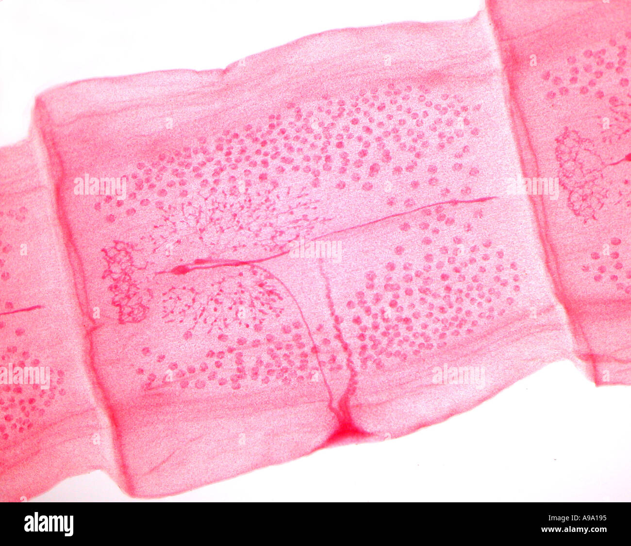 Taenia serrata beef tapeworm young segment stained carmine Stock Photo ...