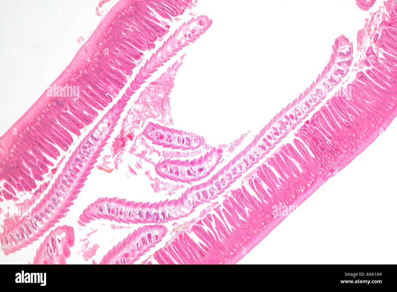 Longitudinal section of mouse intestine showing tapeworms inside ...