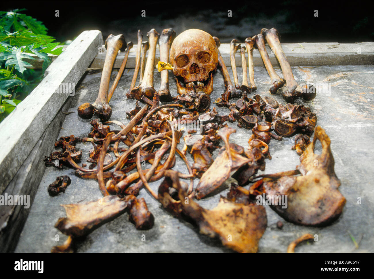 China bone human hi-res stock photography and images - Alamy