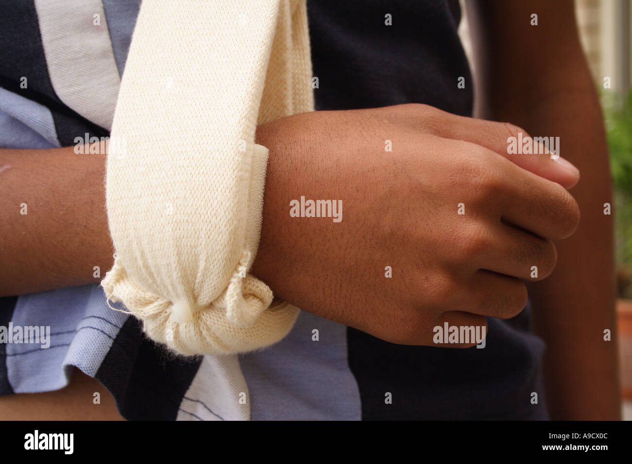 HAND IN A SLING BAPD1543 Stock Photo - Alamy